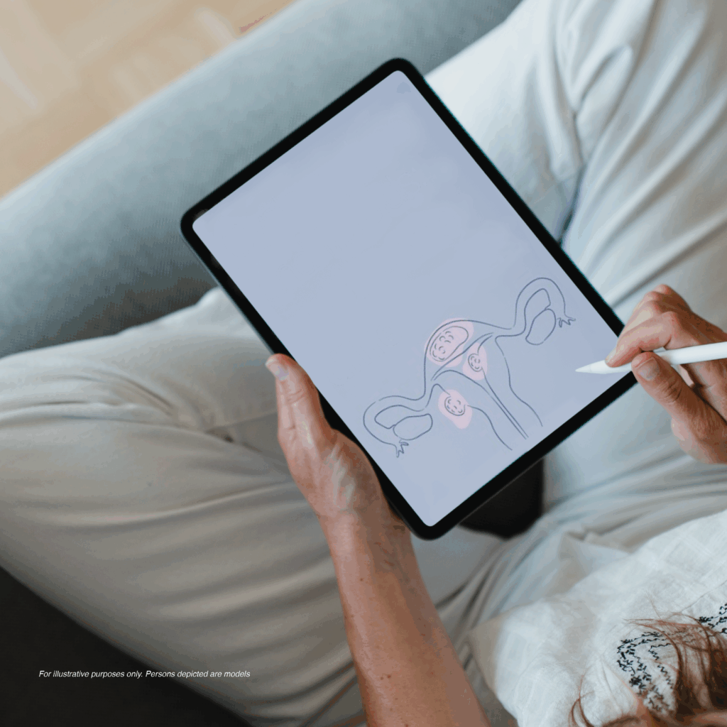 Cysts, Polyps, and Fibroids: What’s the Difference? - Hologic