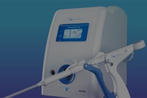 Novasure Endometrial Ablation - Hologic